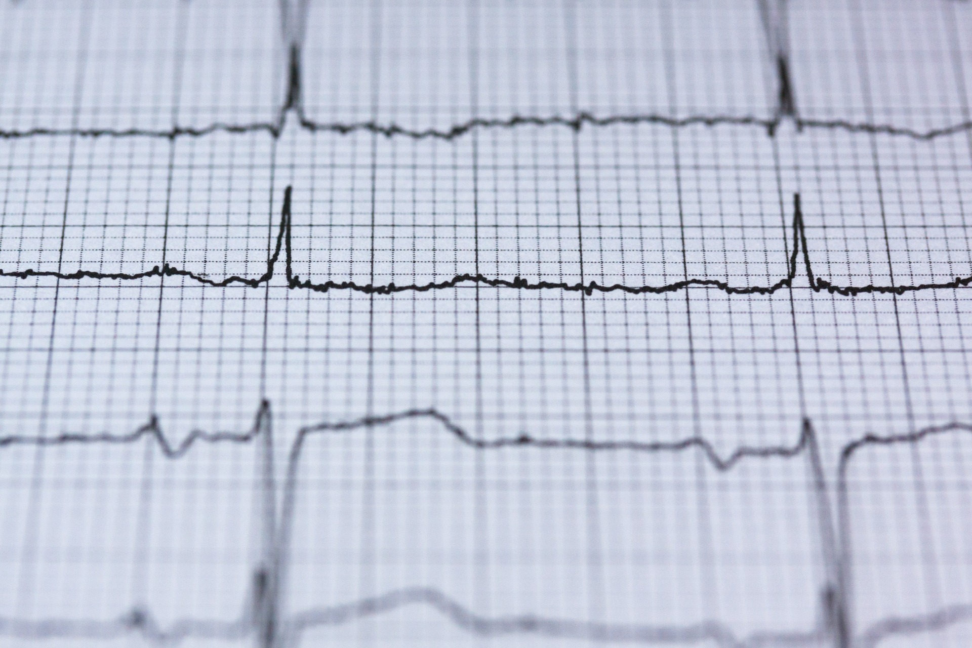 Wat Is HRV Wat Is HRV